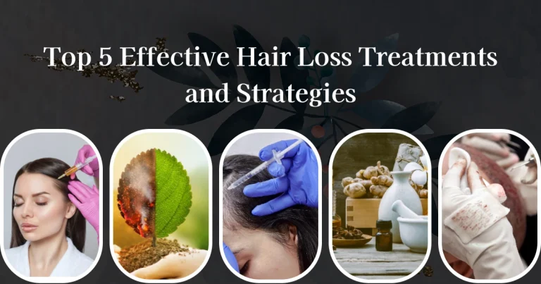 Top 5 Effective Hair Loss Treatments and Strategies in Ahmedabad ...